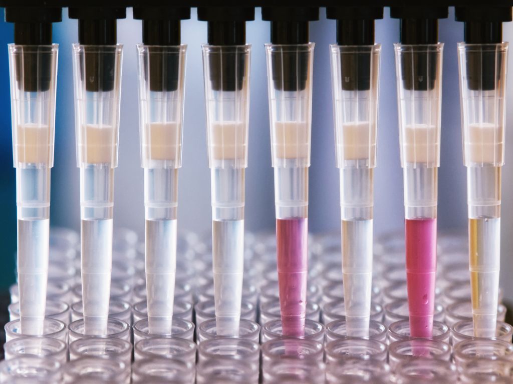 5 applications to get the most out of your flowbot ONE! – Appleton ...